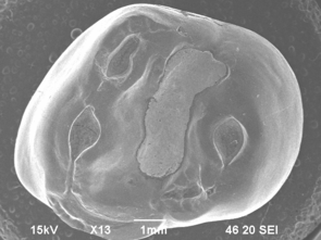 Teeth | Electron Microscopy Core | NDSU