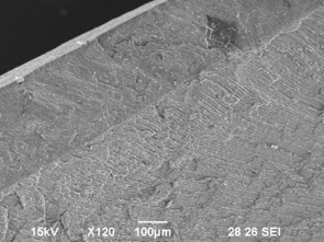 Teeth | Electron Microscopy Core | NDSU