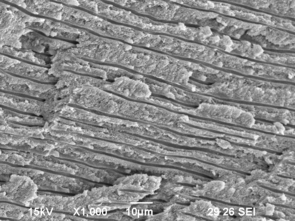 Teeth | Electron Microscopy Core | NDSU