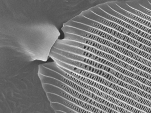 Butterfly Under Electron Microscope
